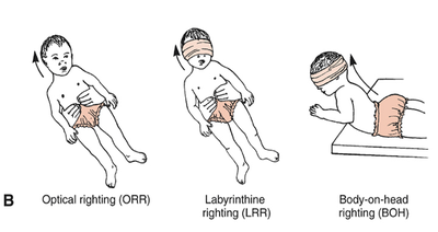 Optical Righting Reflex Infants